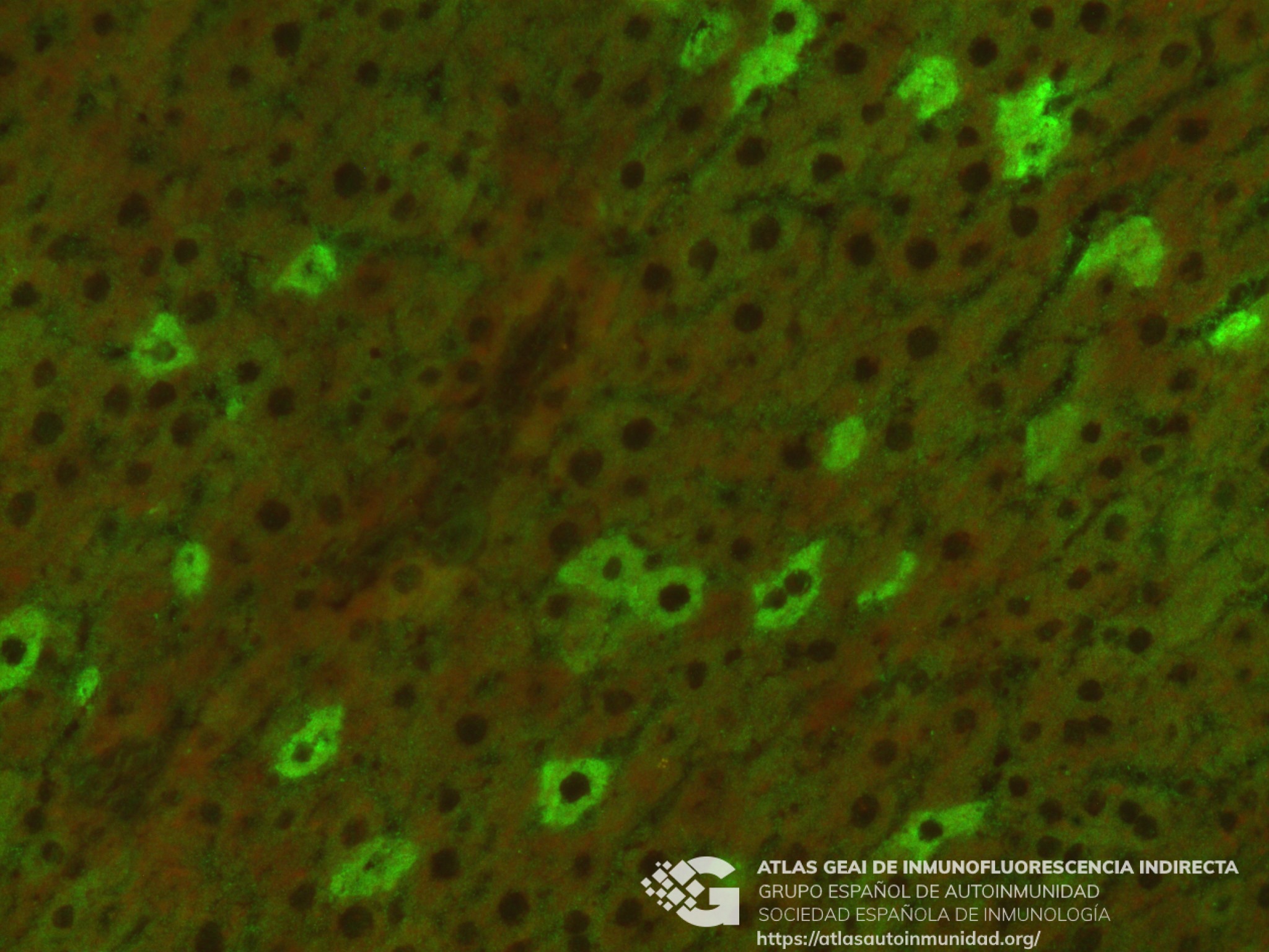 Hepatocitos aislados - Atlas GEAI de Imágenes en Autoinmunidad
