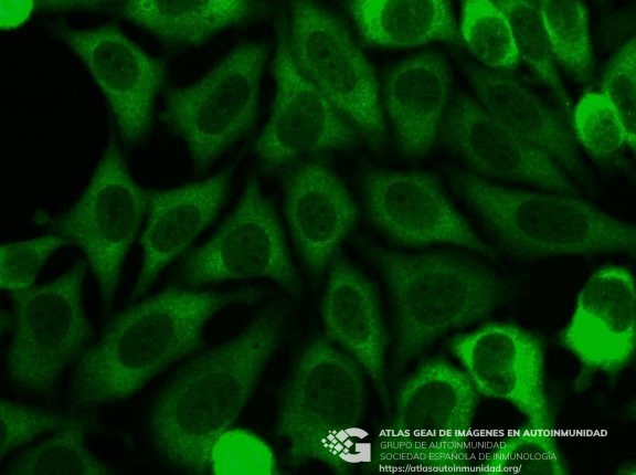 Anti-PL12 - Atlas GEAI de Imágenes en Autoinmunidad