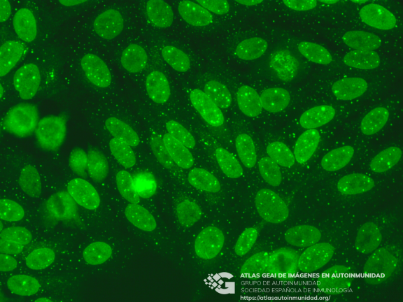 Puntos Nucleares Múltiples/ Membrana nuclear Lisa / Citoplasmático ...