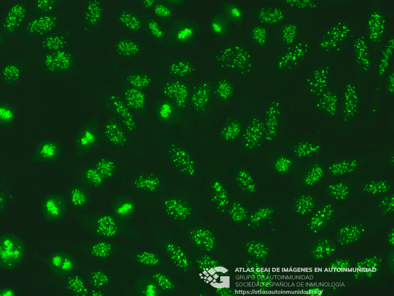 Centrómero - Atlas GEAI de Imágenes en Autoinmunidad