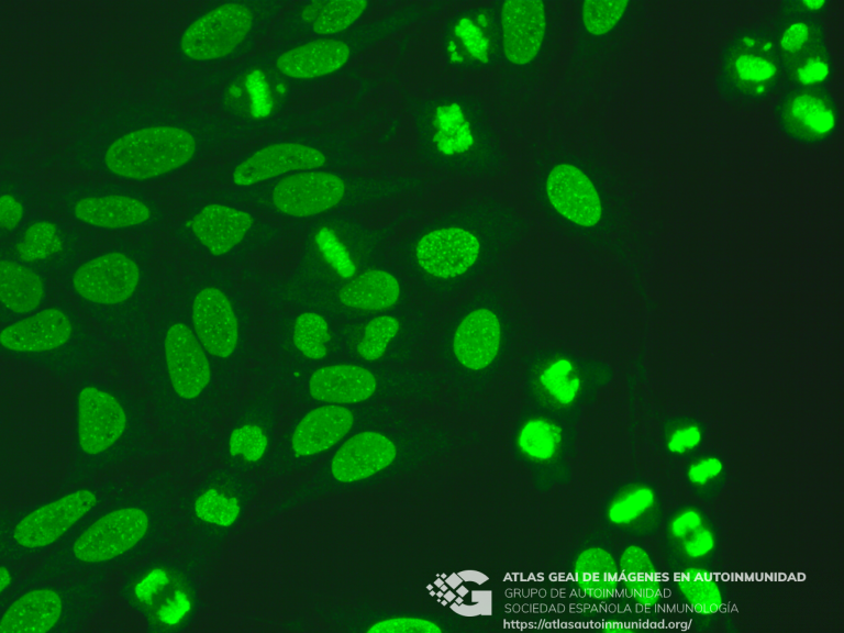 Homogéneo / Centrómero - Atlas GEAI de Imágenes en Autoinmunidad