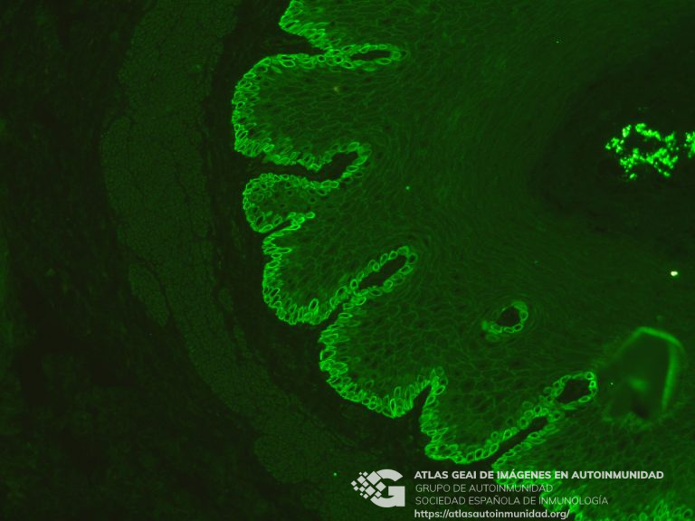 Anti capa de células basales epidérmicas - Atlas GEAI de Imágenes en ...