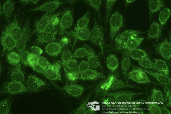 AC-21 Citoplasmático reticular; AC- 12 Membrana nuclear granular; AC-6 ...